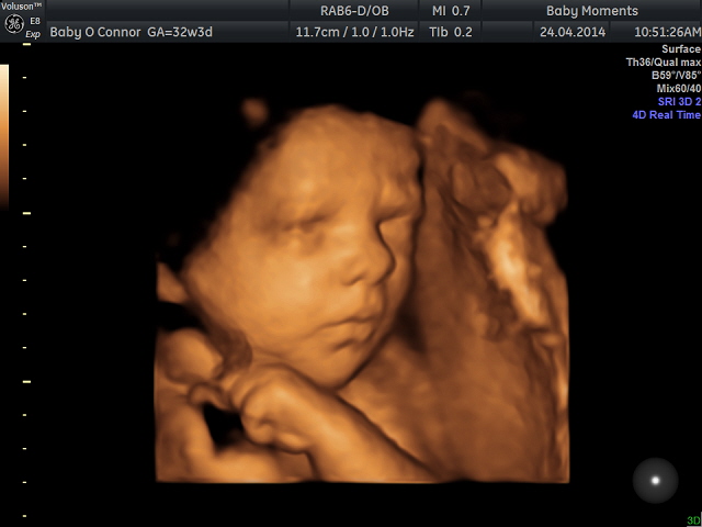 Gallery - Baby Moments 3D 4D ultrasound Scan Centre Oxfordshire Gallery - Baby Moments 3D 4D ultrasound Scan Centre Oxfordshire