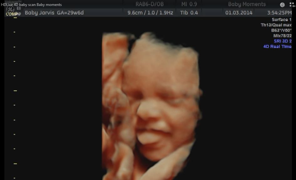 Reassurance Scan 3D 4D Ultrasound Pregnancy Scan Baby Moments